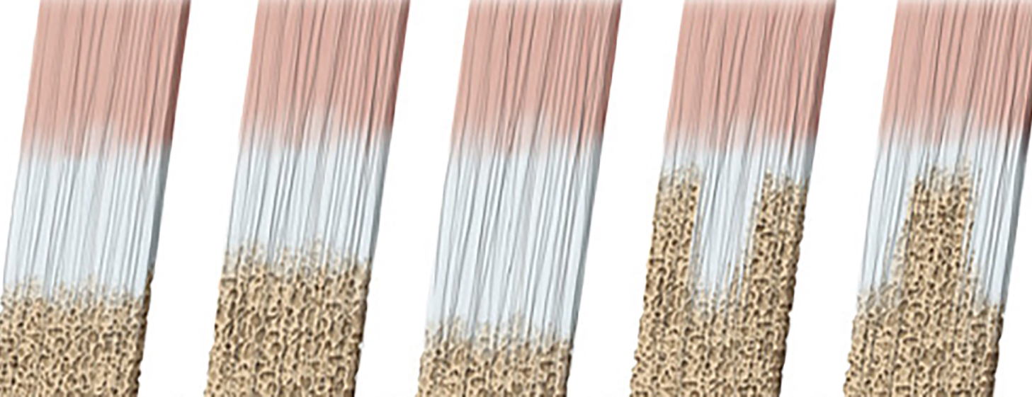 The idea behind Fascial Distortion model (FDM) - PRAXIS FÜR ORTHOPÄDIE ...